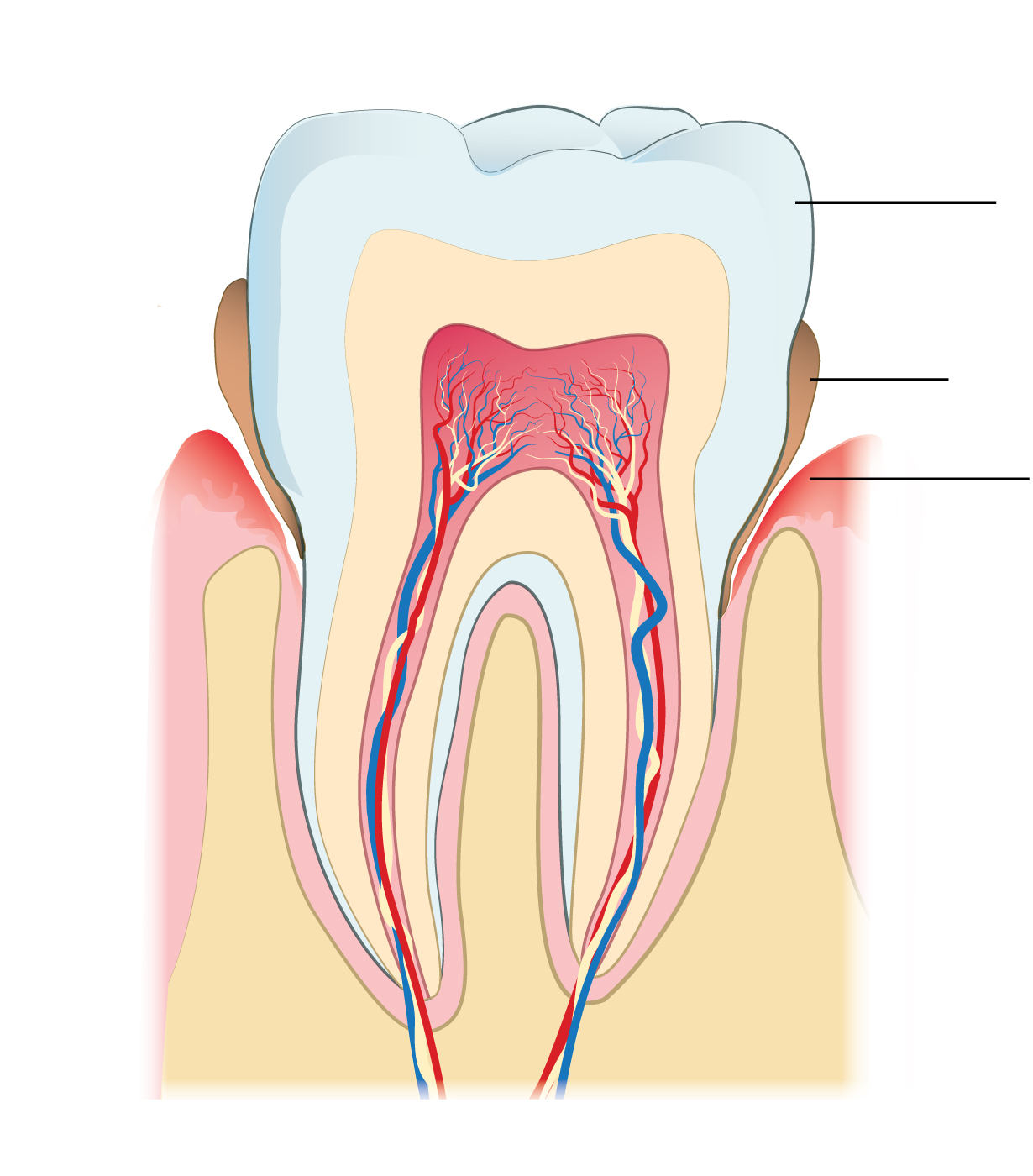 Kuinka hoitaa ientulehdus? | HammasOskari
